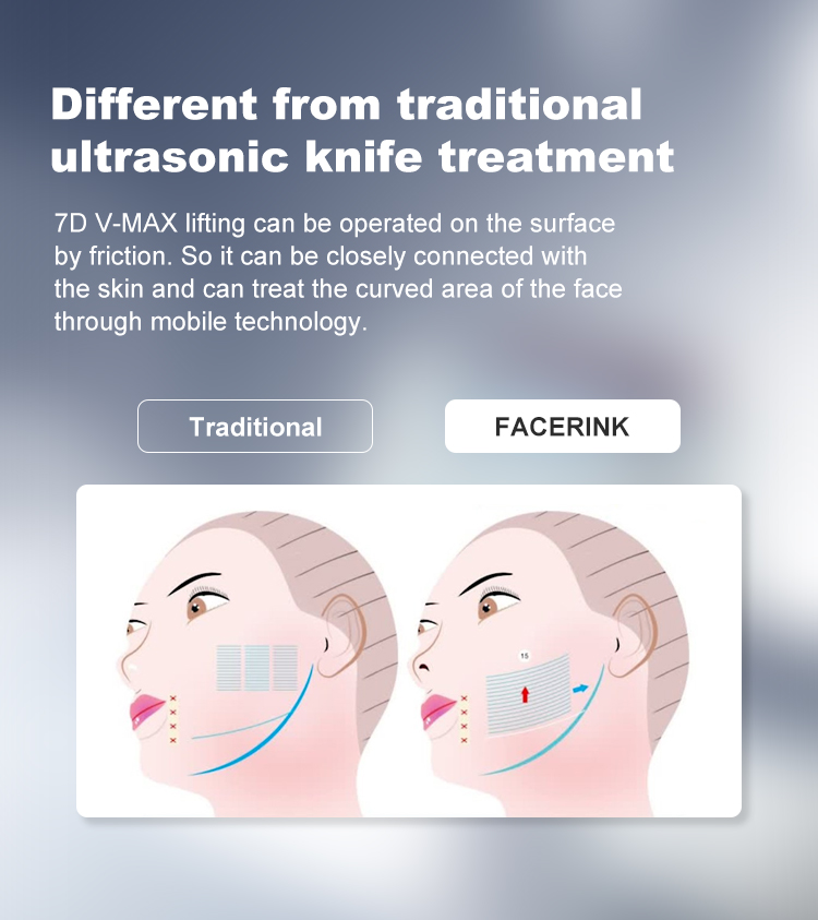 Vmax hifu machine - ODI lazer hair removal machine,slimming machine